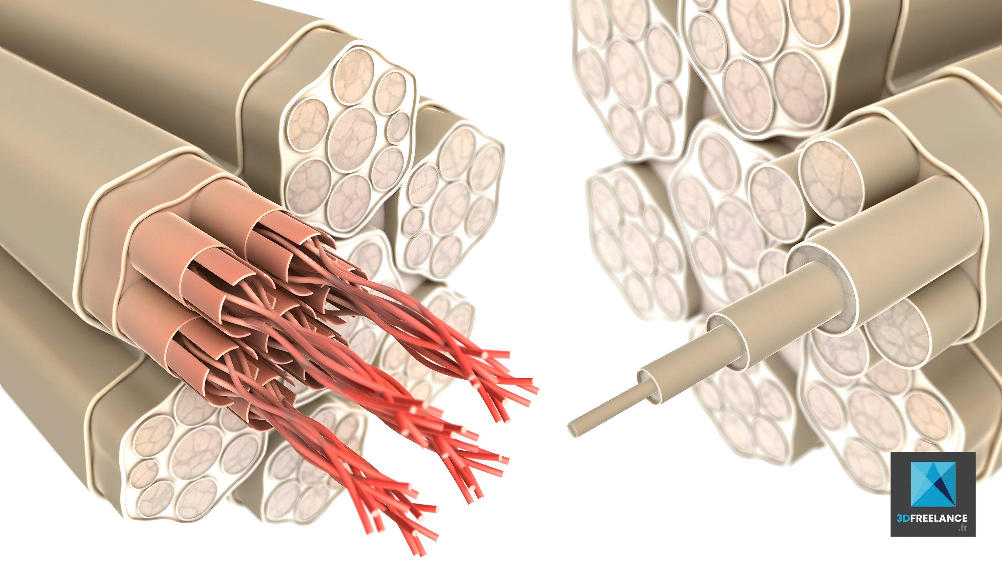 Schéma 3D médical d'une déchirure musculaire - FREELANCE 3D